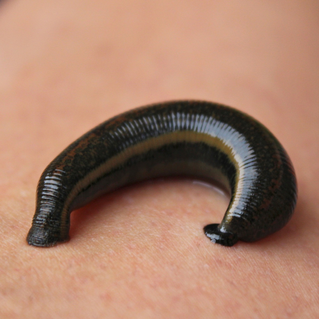 Blutegeltherapie - Heilpraktikerin Berlin Heilpraxis Katrin Schubert